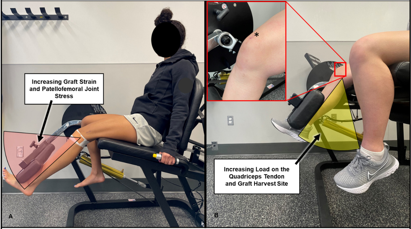 Exercises For Anterior Cruciate Ligament Surgery Infoupdate Exercises For Anterior Cruciate Ligament Surgery Infoupdate